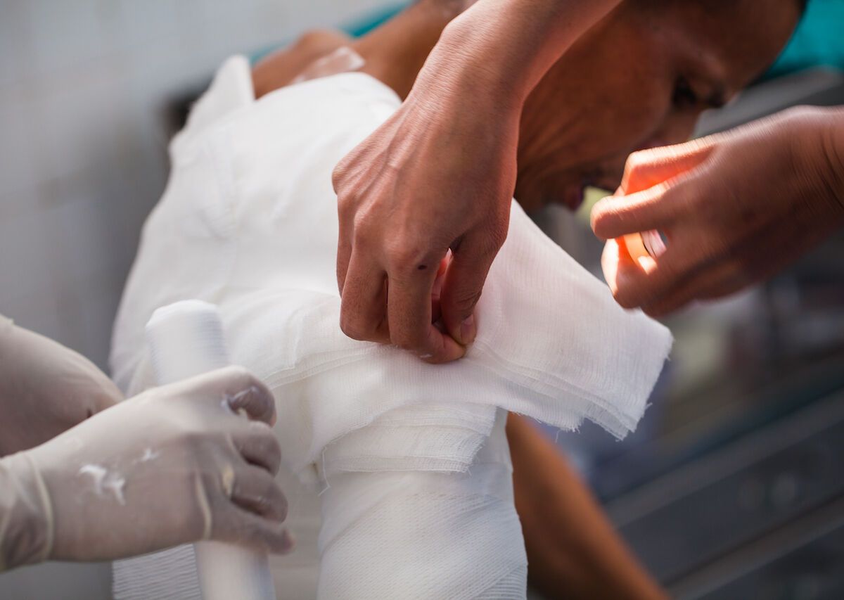 Memories of Life in the Burn Unit