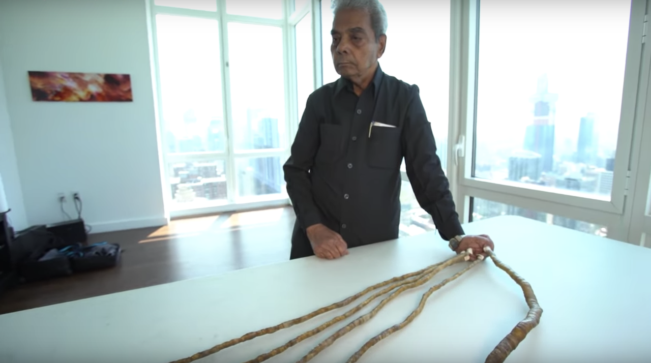 Why the Man With the World's Longest Fingernails Finally Cut Them Off